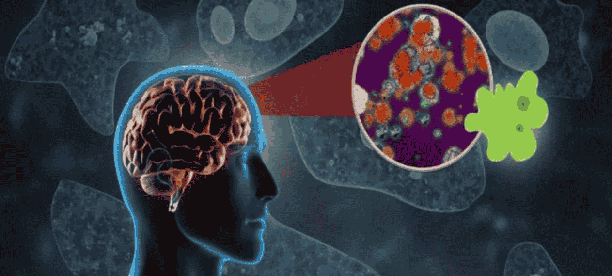 Kerala Saw Rise In Deadly Brain-Eating Amoeba Cases
